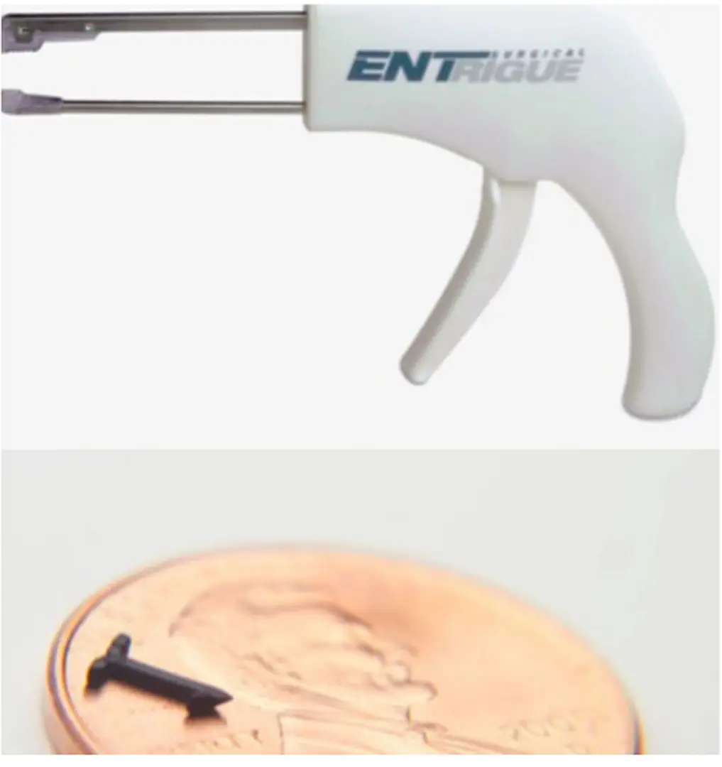 khâu xuyên niêm mạc vách ngăn mũi