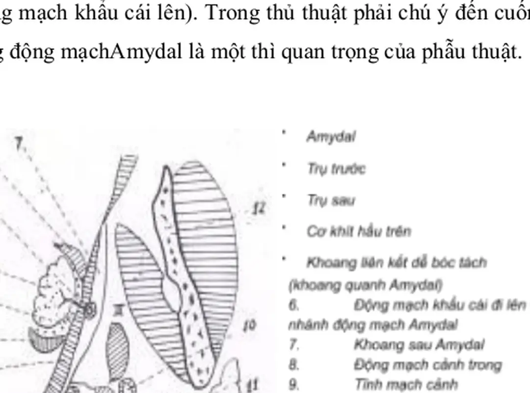 NHẬN XÉT ĐẶC ĐIỂM LÂM SÀNG VÀ ĐÁNH GIÁ KẾT QUẢ PHẪU THUẬT CẮT AMYDAL ...