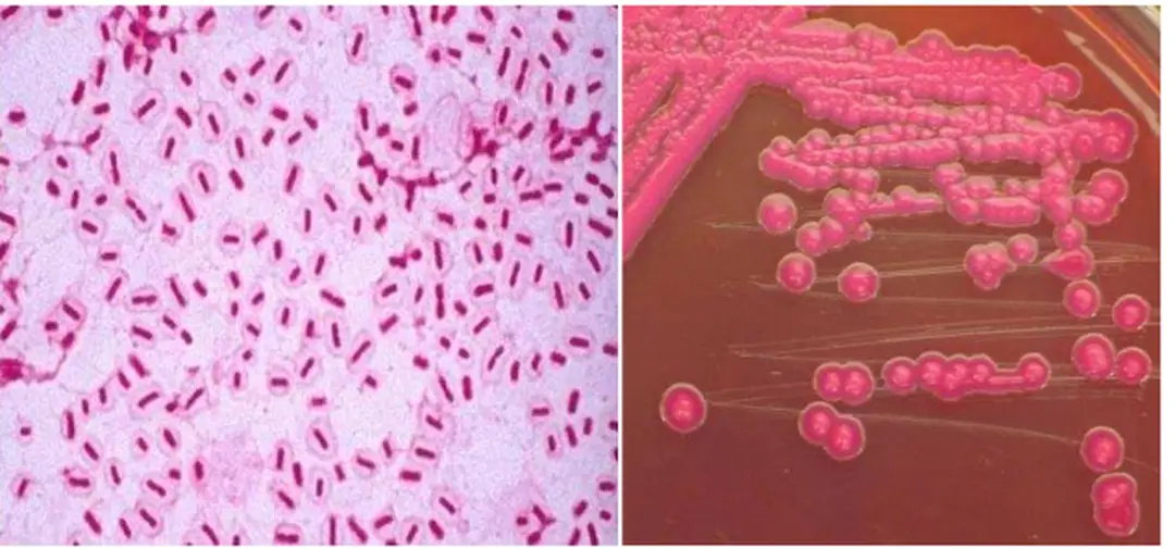 0352GIÁM SÁT TÌNH HÌNH ĐÈ KHÁNG KHÁNG SINH CỦA CÁC VI KHUÂN PHÂN LẬP TỪ BỆNH PHẨM MÁU TẠI BỆNH ...