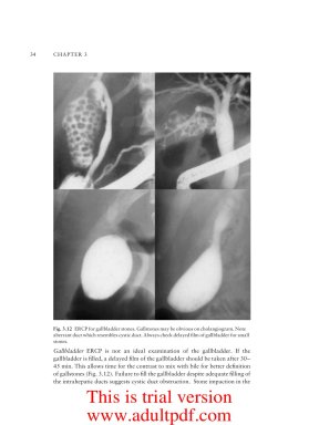 ADVANCED DIGESTIVE ENDOSCOPY: ERCP - PART 2 doc