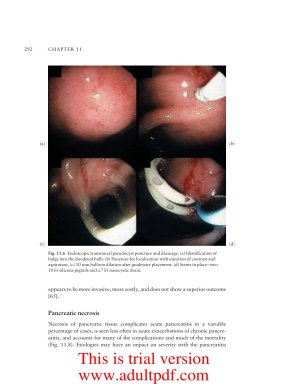 ADVANCED DIGESTIVE ENDOSCOPY: ERCP - PART 8 potx