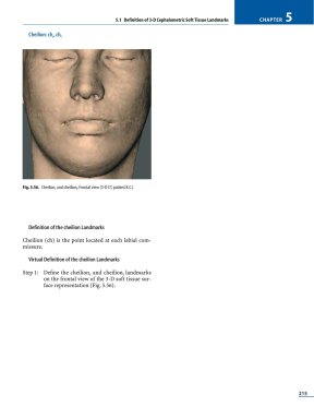Cephalometry A Color Atlas and Manual - part 7 doc