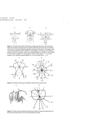 Basic Electrocardiography Normal and abnormal ECG patterns - Part 2 pdf