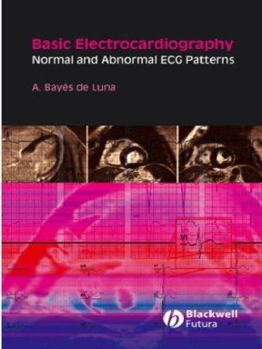 Basic Electrocardiography Normal and abnormal ECG patterns - Part 1 pdf