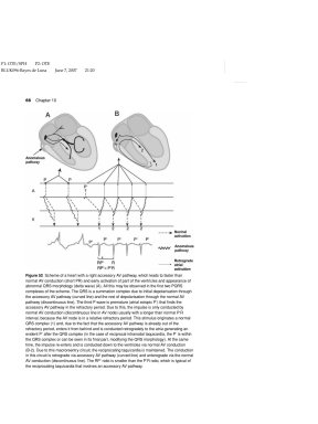 Basic Electrocardiography Normal and abnormal ECG patterns - Part 5 pps