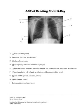 ABC of Reading Chest X Ray