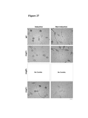 Analysis of regulator of g protein signaling (RGS) function in growth ...