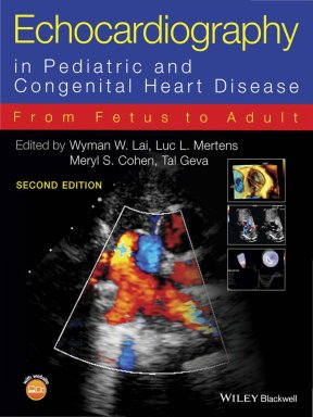 Ebook Echocardiography in pediatric and congenital heart disease from fetus to adult (2nd ...