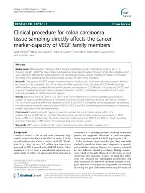Clinical procedure for colon carcinoma tissue sampling directly affects ...