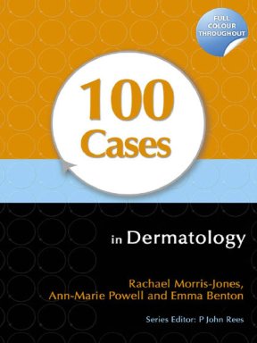100 cases in dermatology