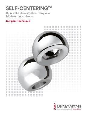 Surgical technique guide SELF CENTERING bipolar modular cathcart ...