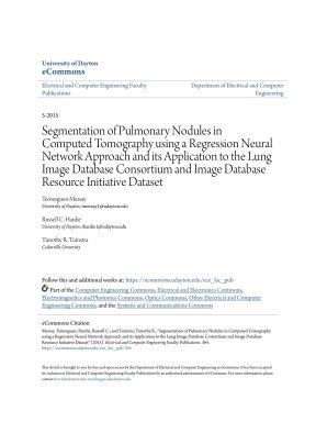 Segmentation of Pulmonary Nodules in Computed Tomography using a