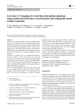 low dose ct imaging of a total hip arthroplasty phantom using model based iterative ...